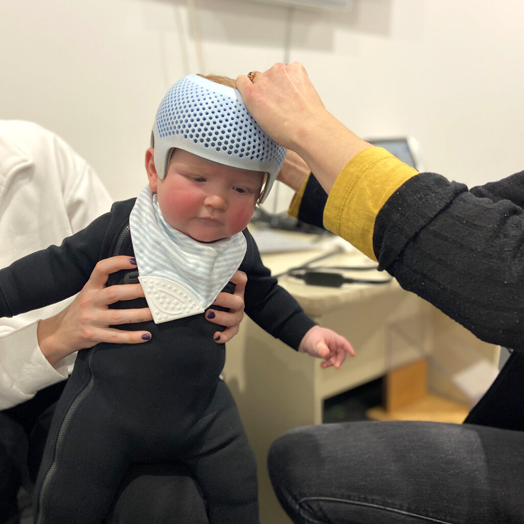 3D Printing and Cranial Remolding Orthosis